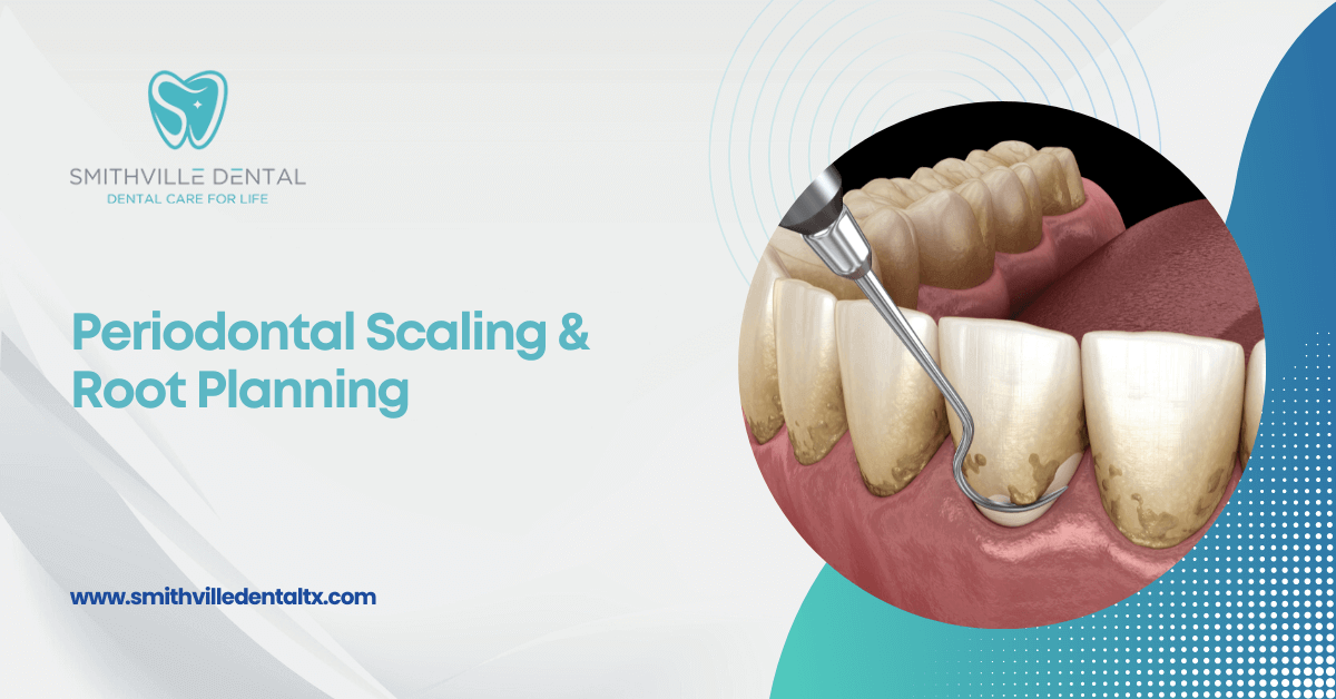Periodontal Scaling Root Planning Smithville Dentist