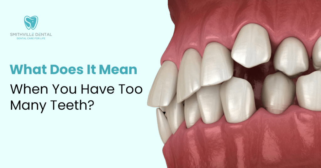 What Does It Mean When You Have Too Many Teeth?